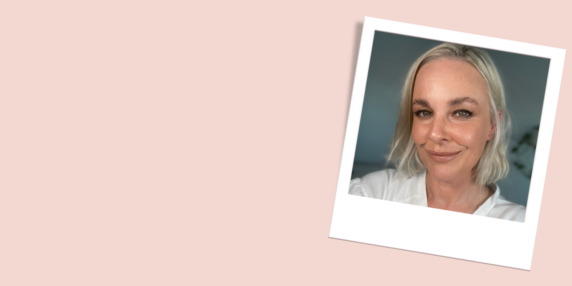 Teen Skin – Amanda Ramsay